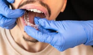 Can Oil Pulling Stain Invisalign Aligners? Benefits, Tips & FAQs